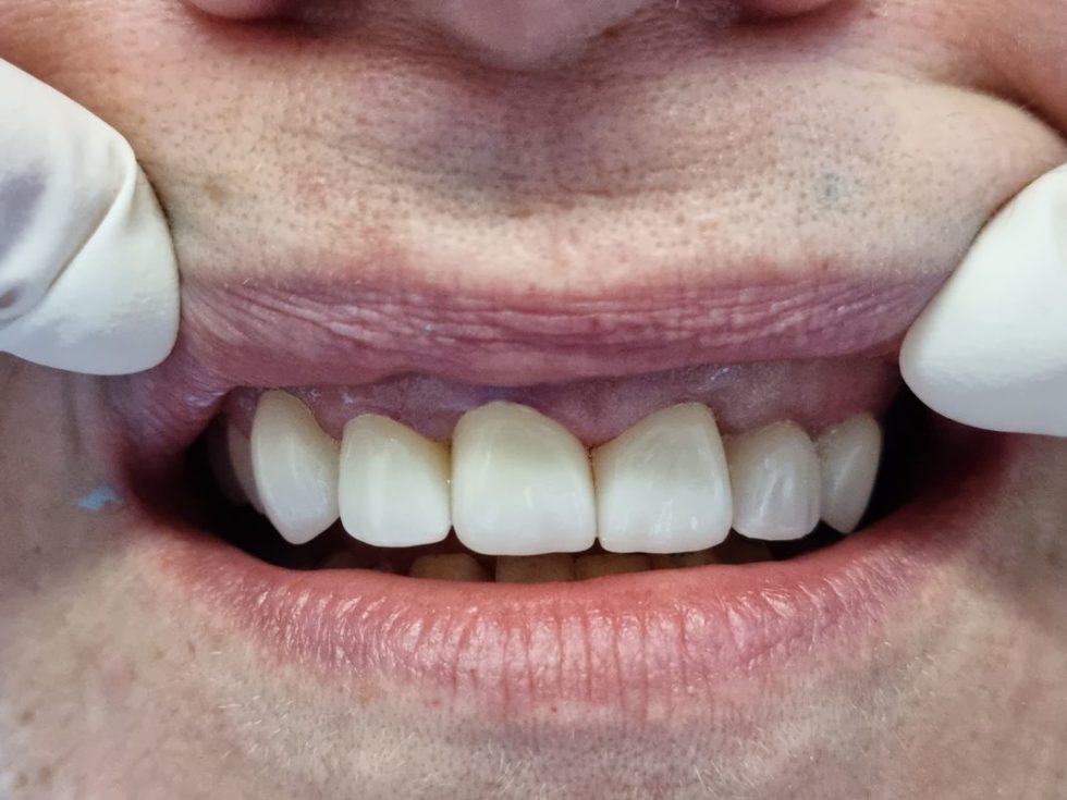 Kroon- en Brugwerk - Tandartsenpraktijk Identity